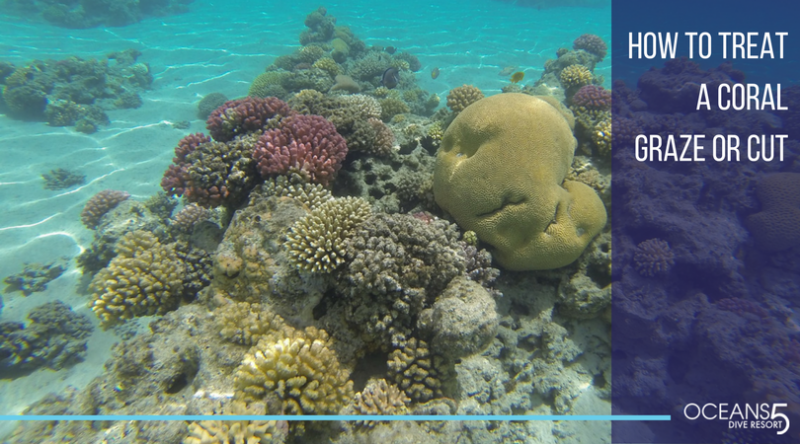 Spines, Stings, and Bites: How to avoid and treat common marine life ...