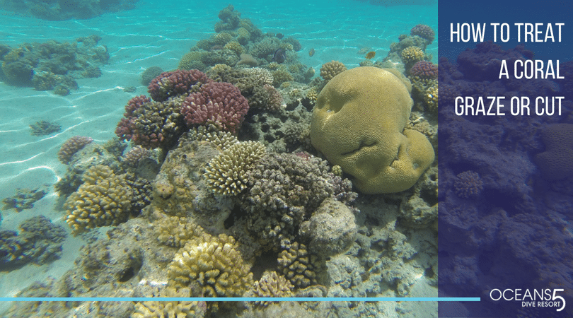 Spines, Stings, and Bites: How to avoid and treat common marine life ...